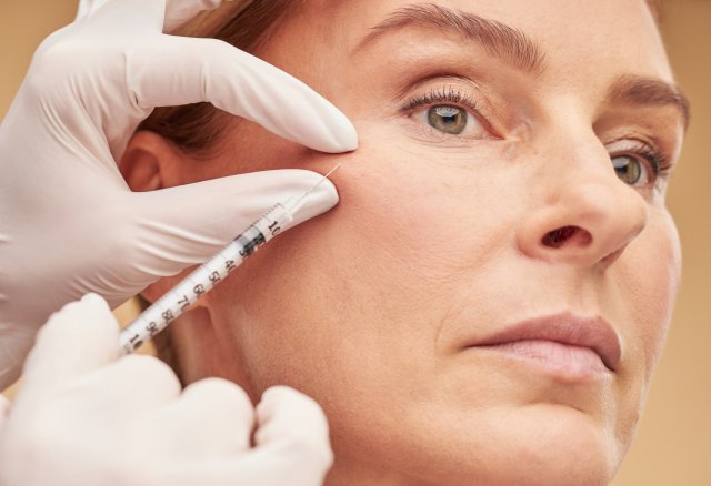 Injections Acide Hyaluronique Pommettes Paris, clinique Champs Elysées